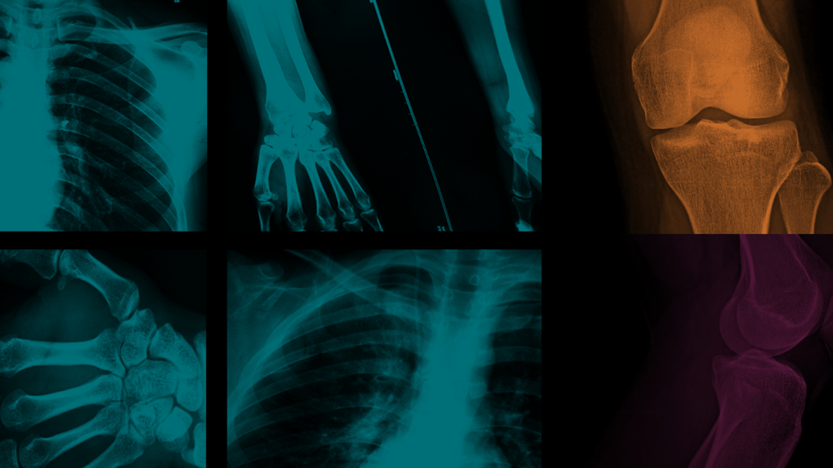 Atrium Health Musculoskeletal Institute and OrthoCarolina Partner to ...